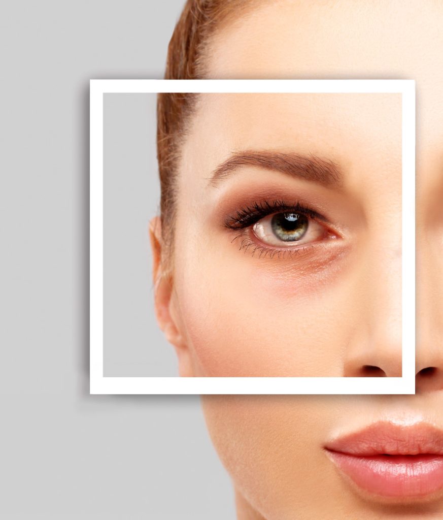 Blefaroplastia - Blefaroplastia y Cirugía de Párpados | Dr. Toribio